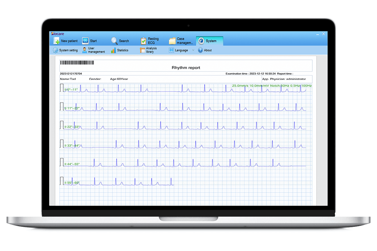 Point-of-Care 12-Lead ECG/EKG Machine Based on A Tablet, with Auto Interpretation & Analysis ...
